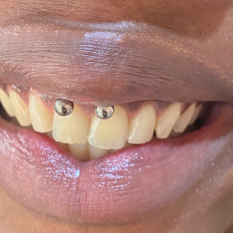 Unlocking The Secrets of Smiley Piercings: A Comprehensive Guide ...