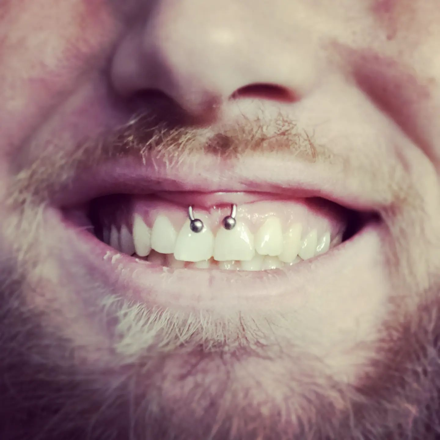 20+ Cool Smiley Piercing Ideas That Make You Look More Attractive ...
