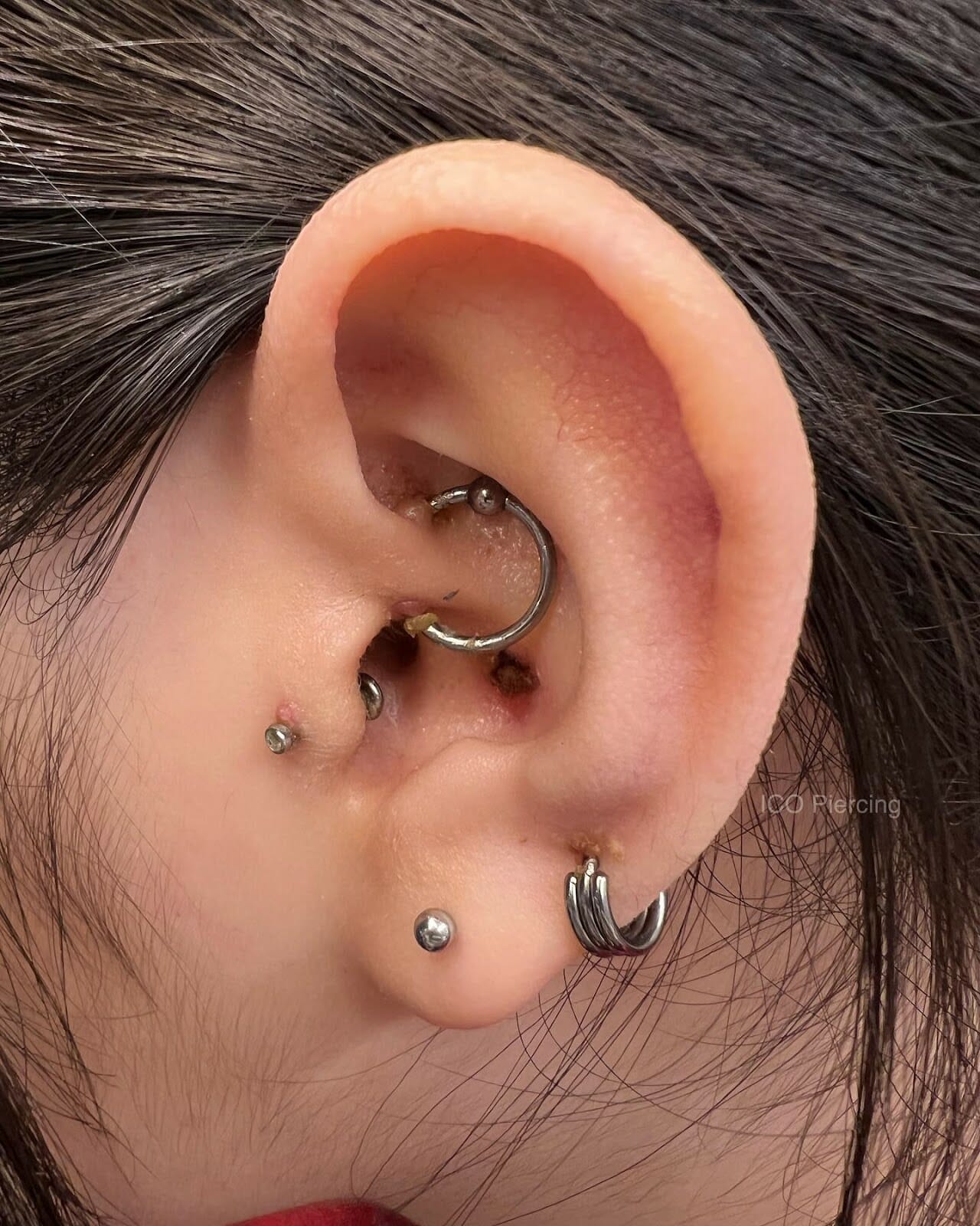 8+ Daith Piercing Ideas That Will Give you an Exotic Look - Psycho Tats