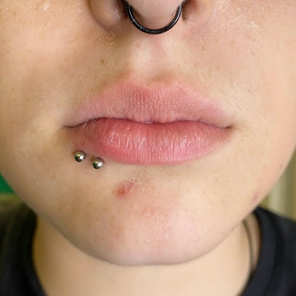 Sensational 10+ Spider Bite Piercing Styles For A Trendy Makeover ...