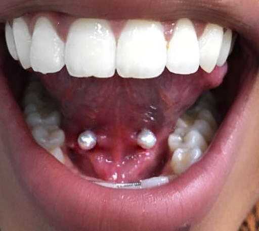 8+ Tongue Frenulum Piercing Ideas That Will Surely Win Your Heart ...