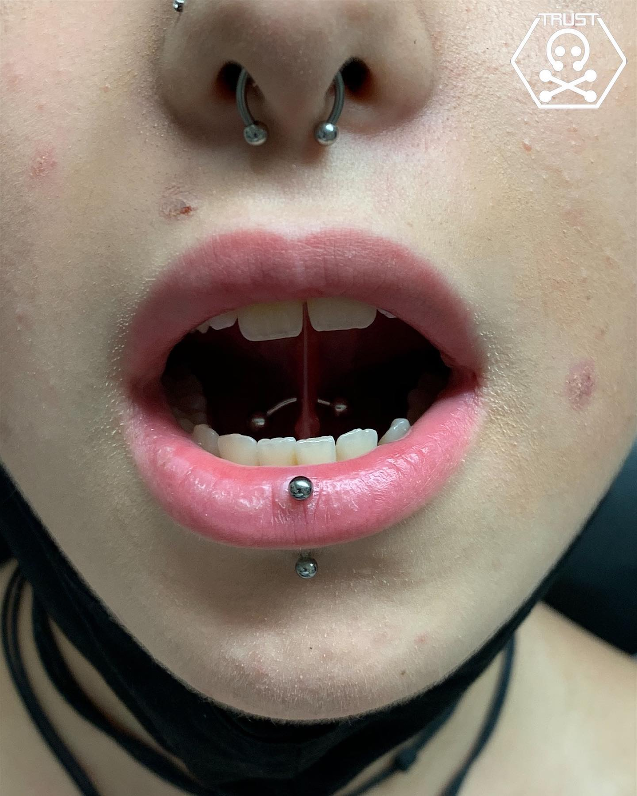 8+ Tongue Frenulum Piercing Ideas That Will Surely Win Your Heart - Psycho Tats