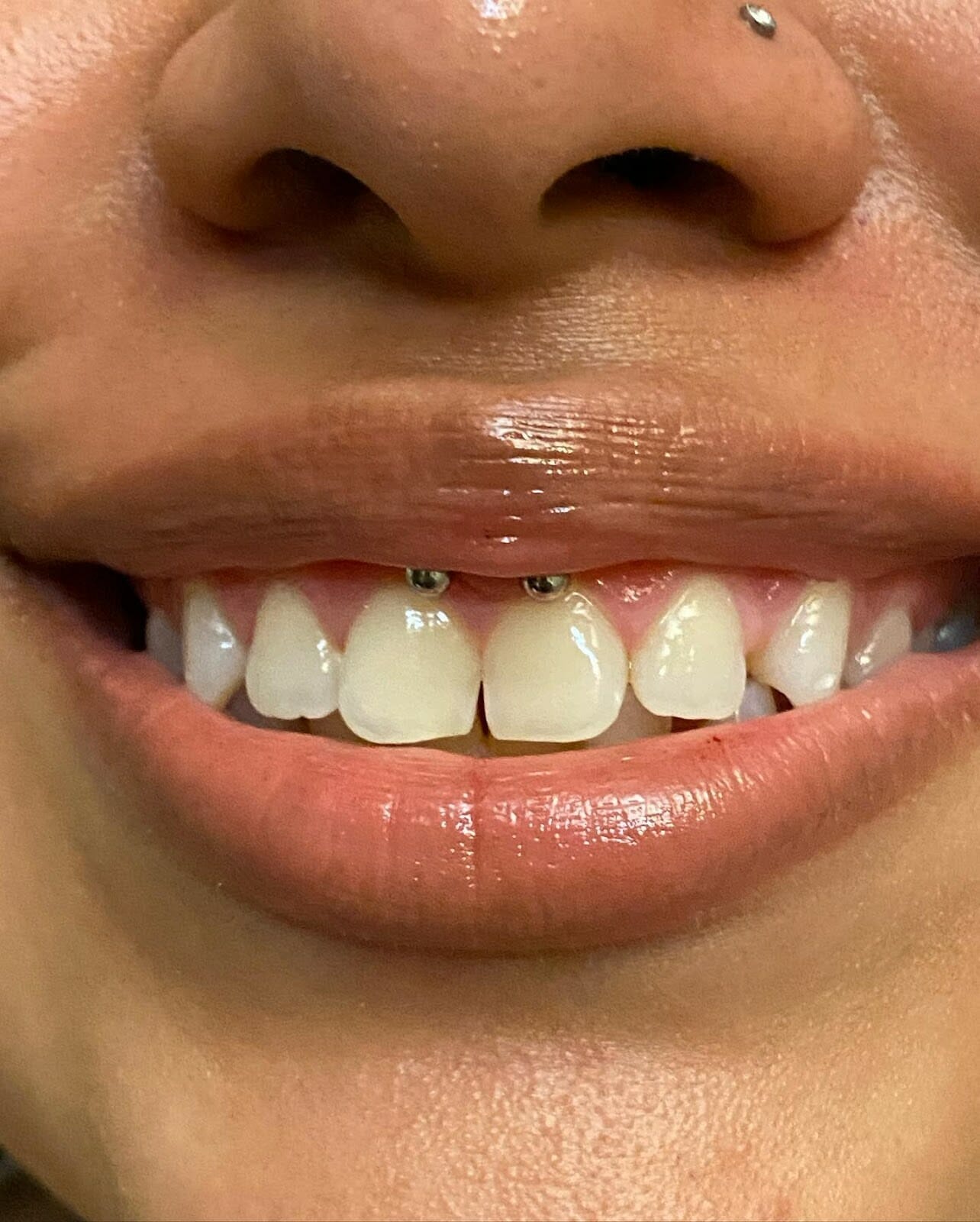 Smiley Piercing Rejection - Psycho Tats