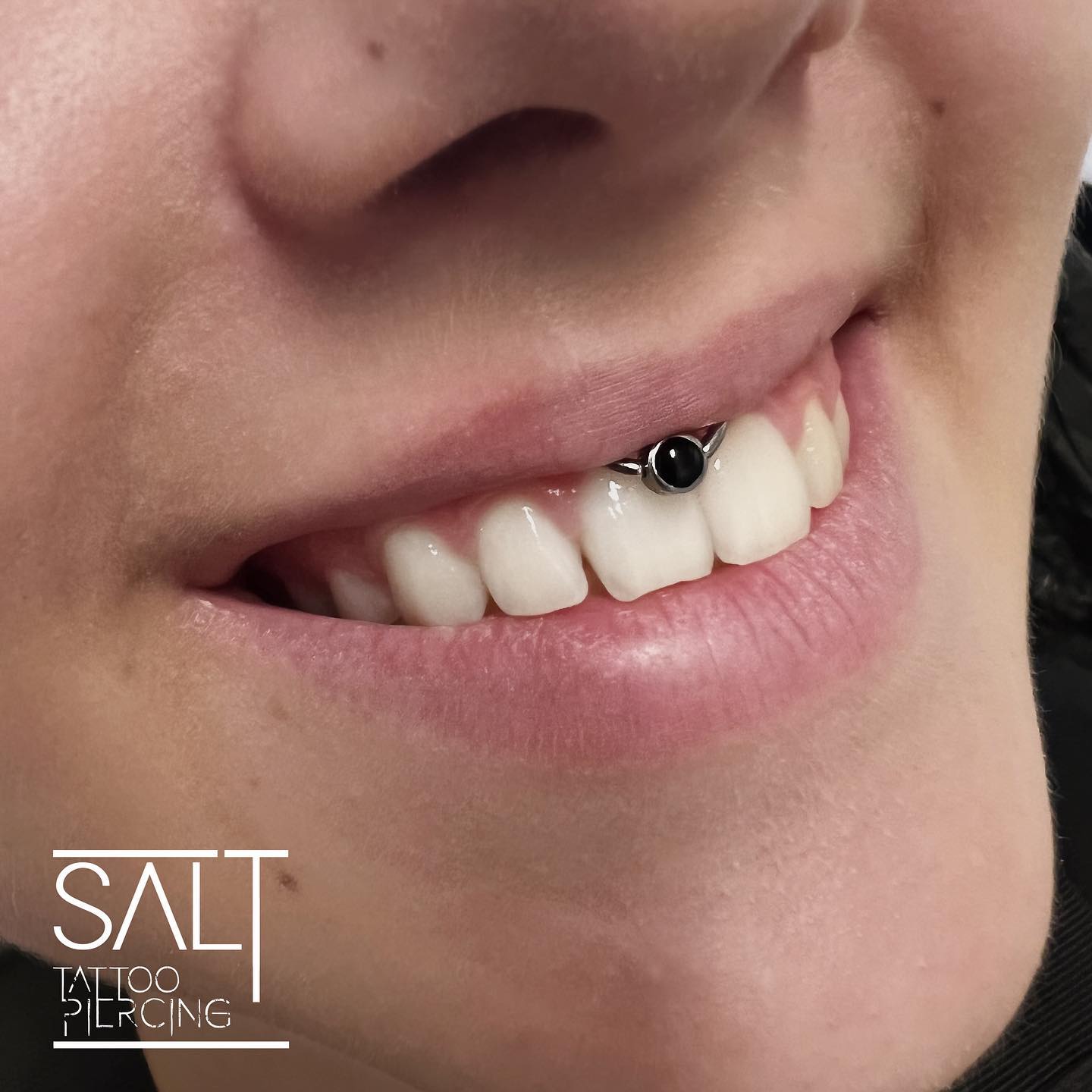 Infected Smiley Piercing Meaning, Infections, And Aftercare - Psycho Tats