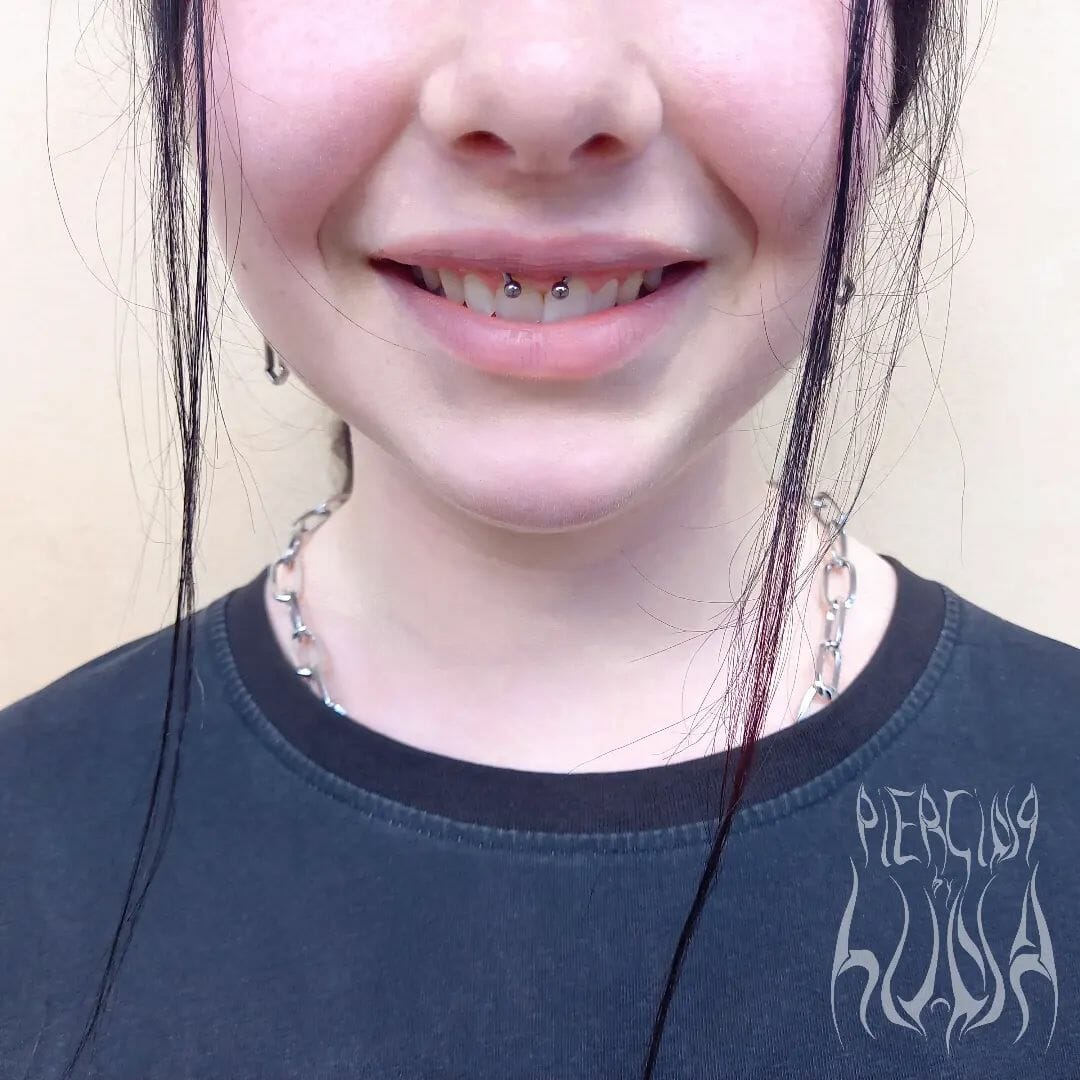 Infected Smiley Piercing Meaning, Infections, And Aftercare - Psycho Tats