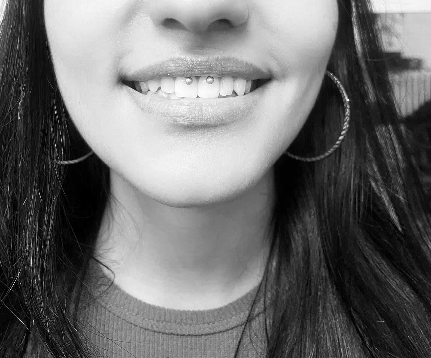 Infected Smiley Piercing Meaning, Infections, And Aftercare - Psycho Tats