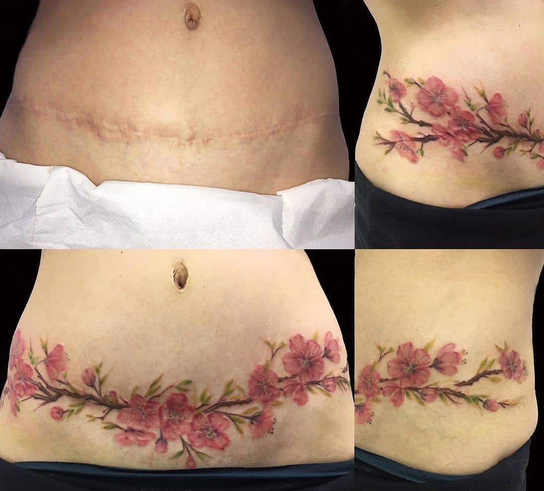 What Causes Tattoo Scarring And How Can You Avoid Them? - Psycho Tats