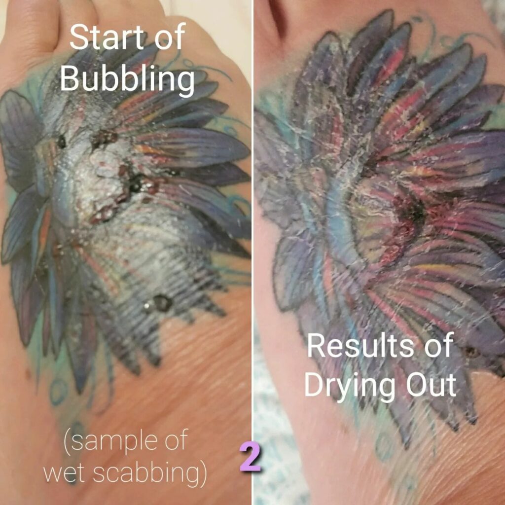 Why Do Tattoo Bubbles Grow And How Can You Get Rid Of Them? - Psycho Tats